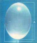 N&S Testicular Prosthesis